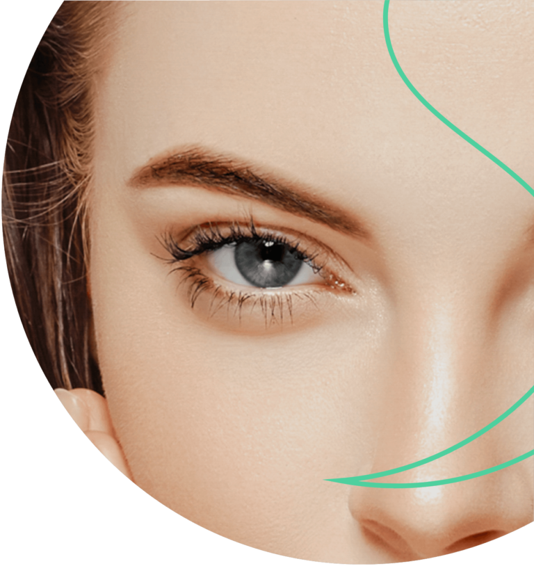 Thread Lift Cosmetic Procedure | Smile More Solihull